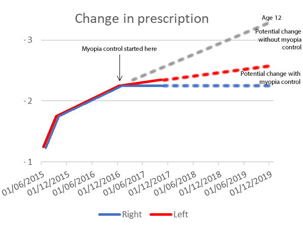 Myopia Control - Central Vision Opticians
