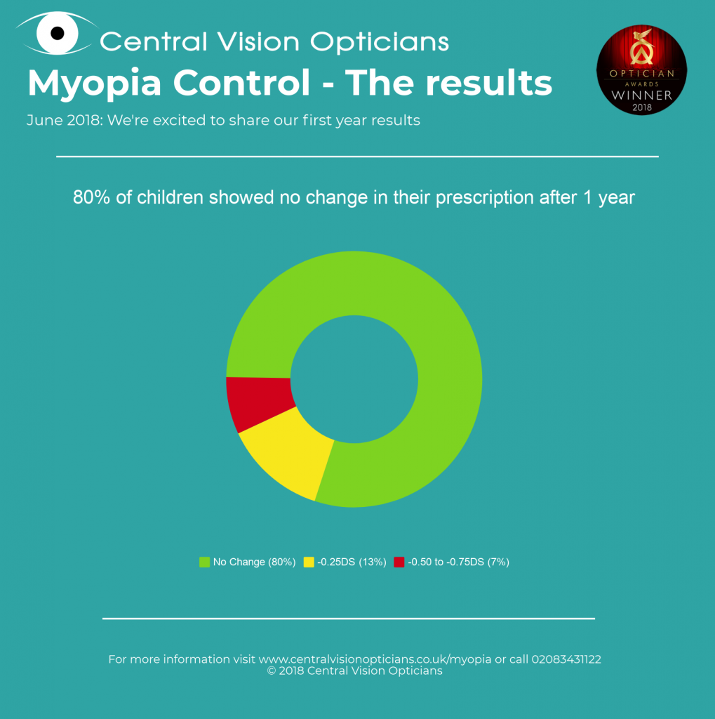 Read this before your child wears MiSight contact lenses for myopia ...